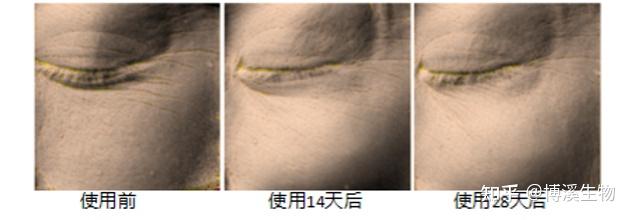 化妆品抗衰功效评价方法概述 知乎