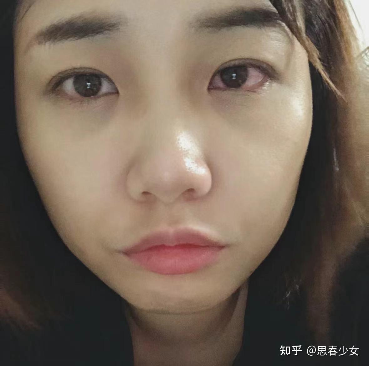 买了护眼的谛若敏普叶黄素,是智商税吗?吃完3瓶真实反馈! 知乎