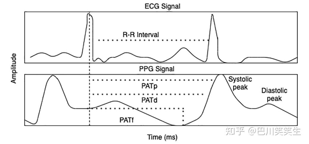 生物传感器机器学习血压估计综述 - 知乎