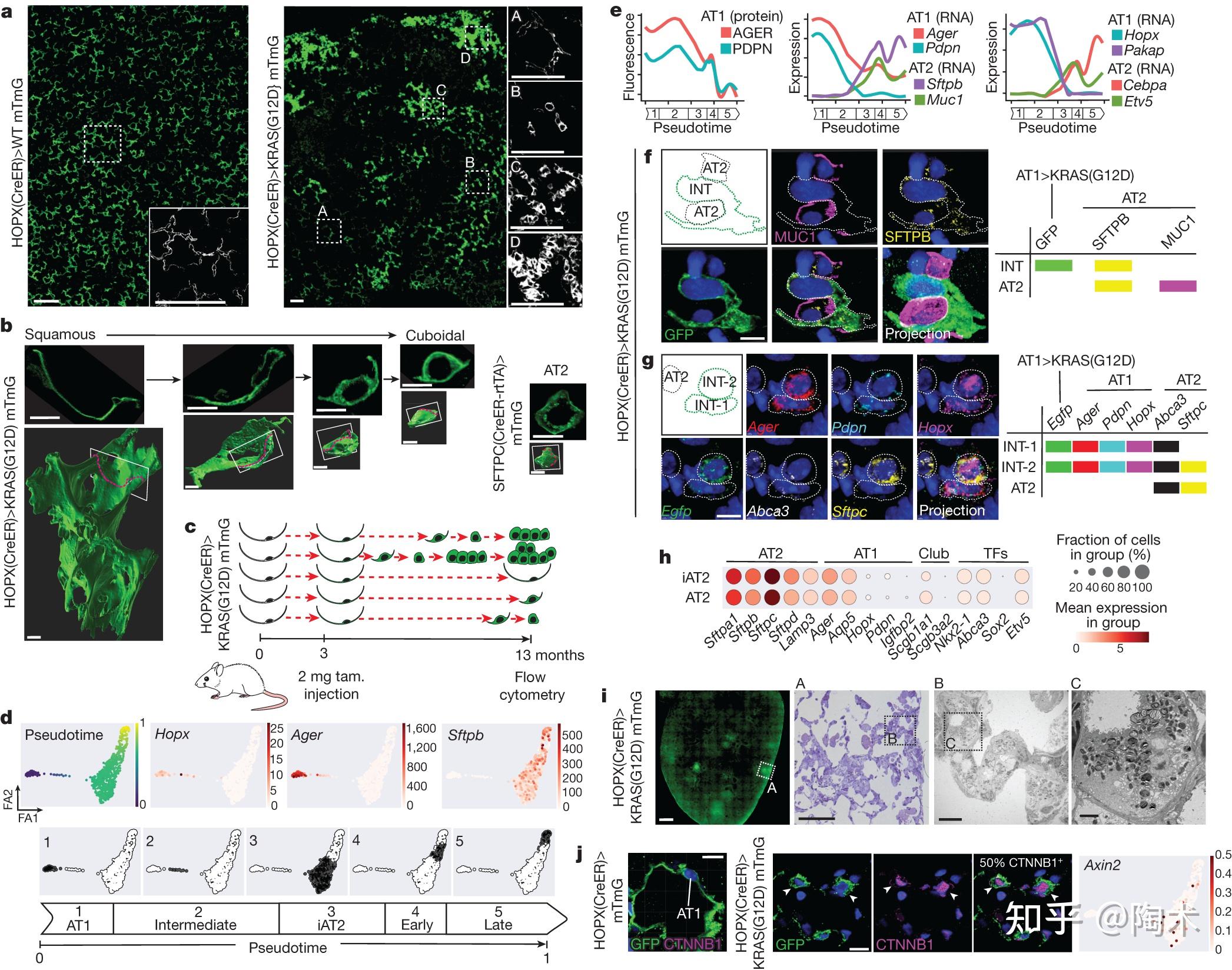 Nature重磅！揭秘KRAS（G12D）驱动鳞状肺腺癌新机制！！ - 知乎