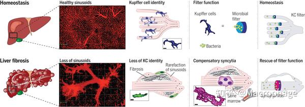 《Science》: 类Kupffer cells (KCs)细胞集群代偿补充纤维化肝脏中定居巨噬细胞的功能 - 知乎