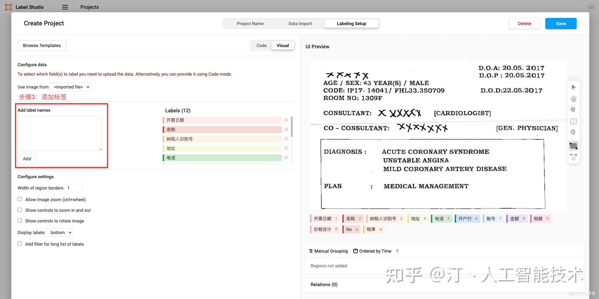 2.基于Label studio的训练数据标注指南：（智能文档）文档抽取任务、PDF、表格、图片抽取标注等 - 知乎