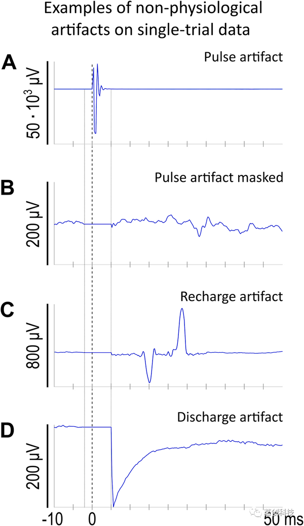 rt-TEP工具：实时显示TMS诱发电位，最大化皮层激活和最小化伪影 - 知乎
