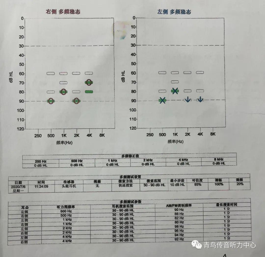 大前庭的案例分析和跟踪 - 知乎