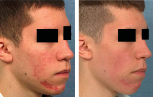 Rox Anderson：从激光医学之父到最成功的医生创业者 - 知乎