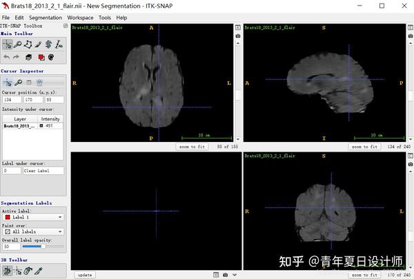 全网最详细 Python如何读取NIFTI格式图像（.nii文件）和 .npy格式文件和pkl标签文件内容 - 知乎