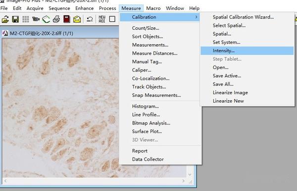 聊一聊 Image-Pro Plus 测量平均光密度。 - 知乎