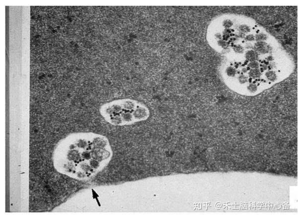 从“细胞垃圾”到“研究热点”| 带你了解外泌体的逆袭史 - 知乎