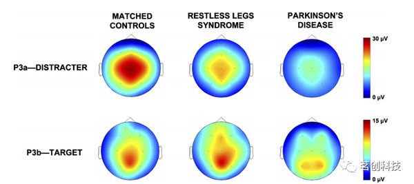 经典再读 | P3a与P3b的整合理论 - 知乎