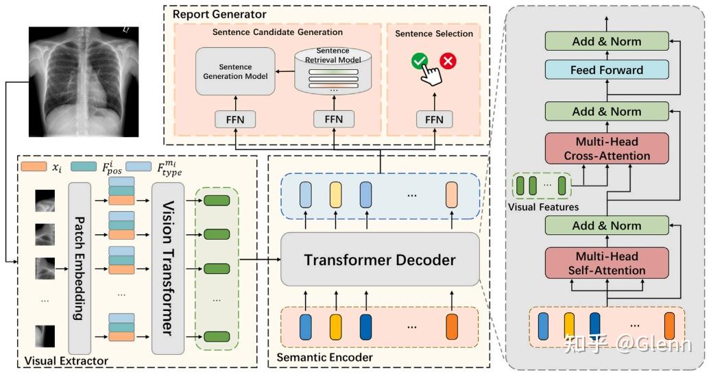 [论文阅读][速览] MIA | Volume 91（January 2024） - 知乎