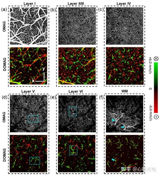 Opt. Lett.：液体变焦镜头结合OCTA进行小鼠大脑深层皮质血流成像 - 知乎