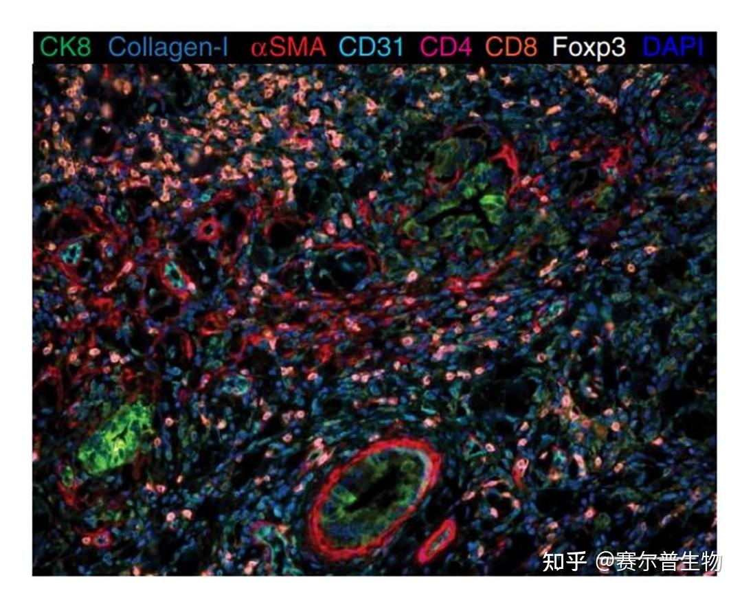 多色荧光免疫组化（mIHC）技术的主要类型 - 知乎