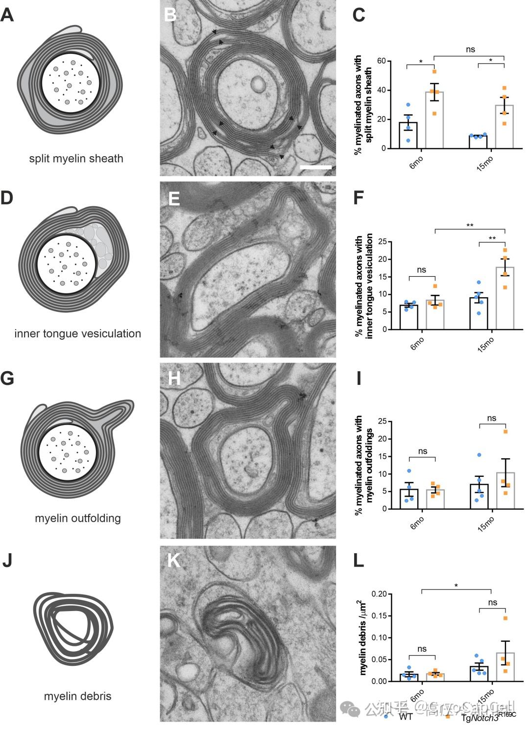 采用高压冷冻/冷冻替代法（HPF/FS）对 CADASIL小血管病脑白质早期超微结构变化的特征研究 - 知乎