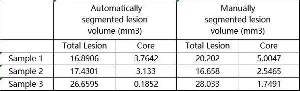 文献解读：小鼠中风模型 高分辨率micro-CT成像:从梗死表征到自动区域分割 - 知乎