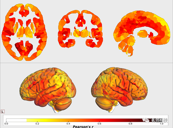 基于体素形态学测量分析(VBM)的工具包比较及其在年龄预测中的应用 - 知乎
