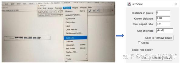 手把手教学——WB条带量化之ImageJ软件分析 - 知乎
