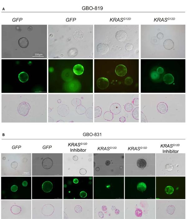 新时代研究模型 | 类器官与慢病毒更配哦！ - 知乎