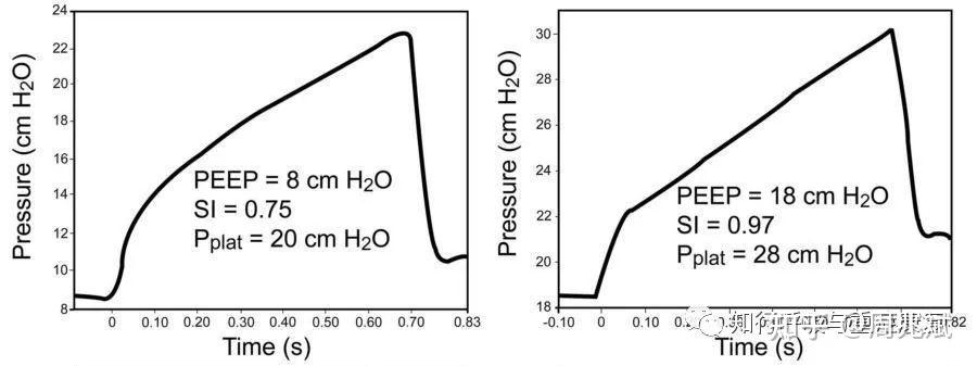 第149期 滴定PEEP的9个方法 - 知乎