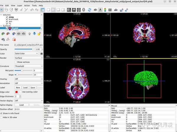 学习笔记431—freesurfer下载安装，常用术语和recon-all命令 - 何弈 - 博客园
