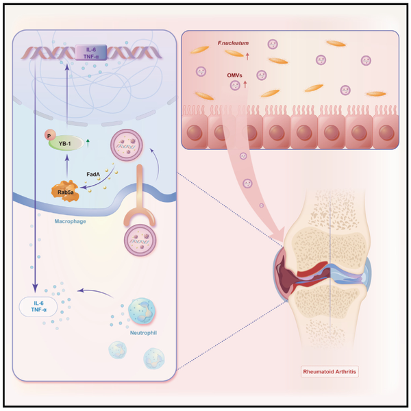 Cell子刊 | 南方医科大学发现具核梭杆菌通过含FadA的外膜囊泡加重类风湿性关节炎 - 知乎