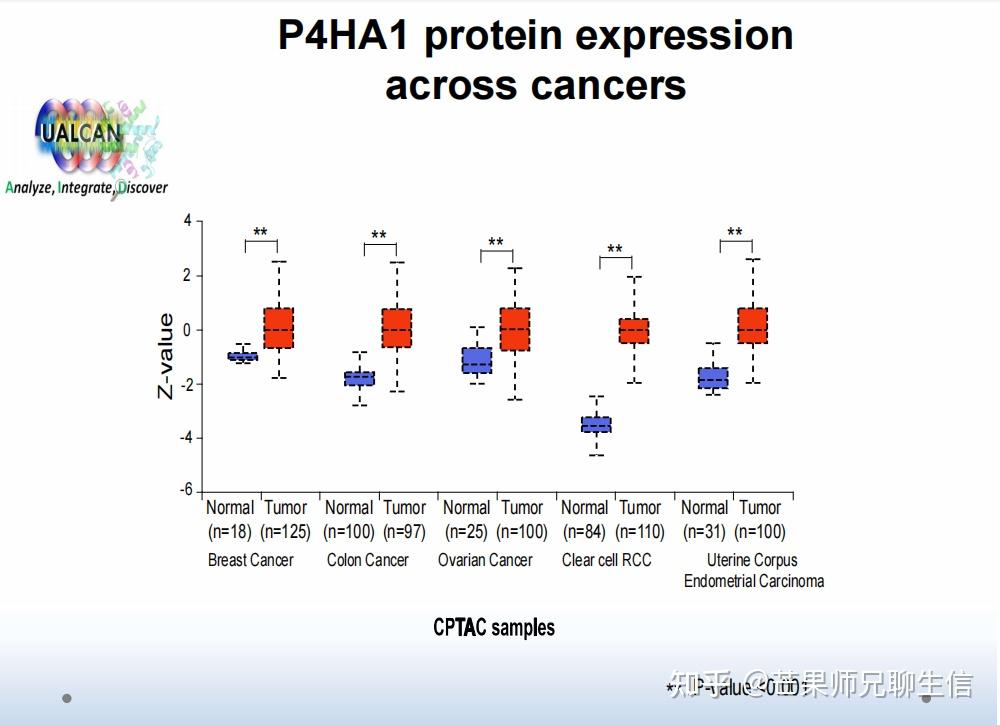 肿瘤免疫 · 实操教程Day10.UALCAN使用教程 - 知乎