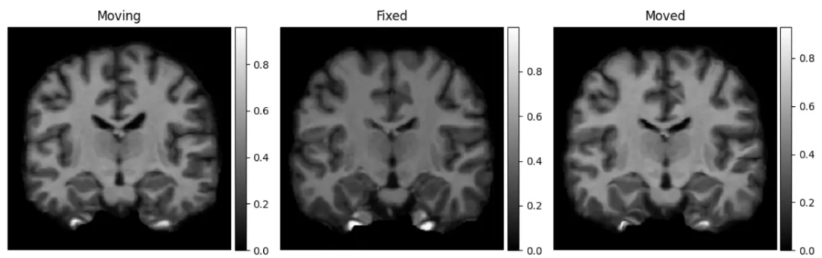 分割图——SynthMorph，零样本学习完成跨模态配准任务 - 知乎