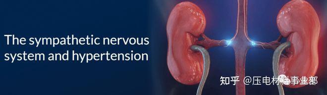 超声肾去神经（RDN）压电陶瓷圆管-超声消融导管 - 知乎