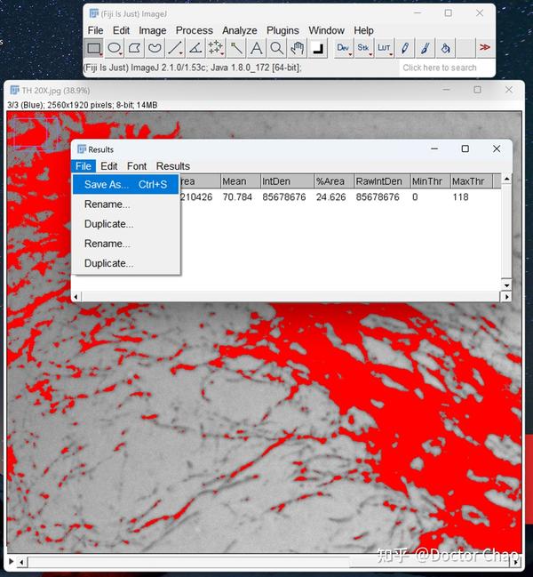 组化片子如何利用Image J 进行阳性信号面积占比统计分析 - 知乎