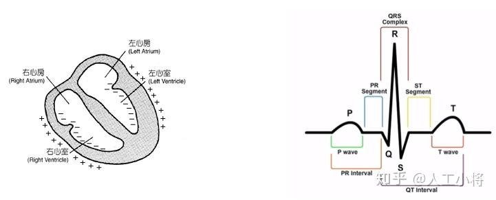 深度医疗(1) - 基于深度学习心电图(ECG)特征识别 - 知乎