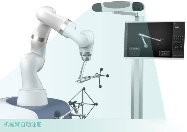 获批NMPA！膝关节置换手术导航定位系统 - 知乎