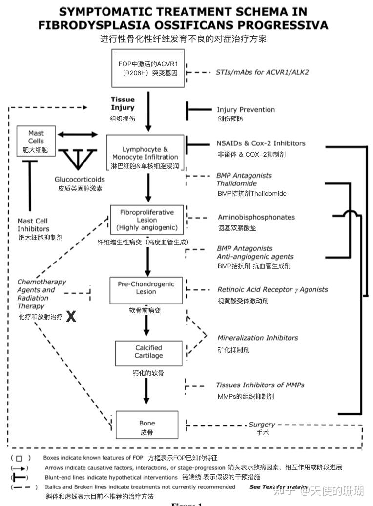 FOP：诊断、管理和治疗前景 - 知乎