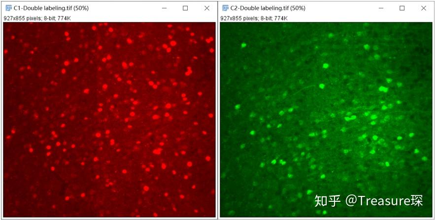 ImageJ实用技巧——荧光共标细胞计数(解放双手篇) - 知乎