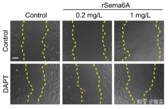 老司机带你解锁ImageJ划痕实验宽度分析 - 知乎