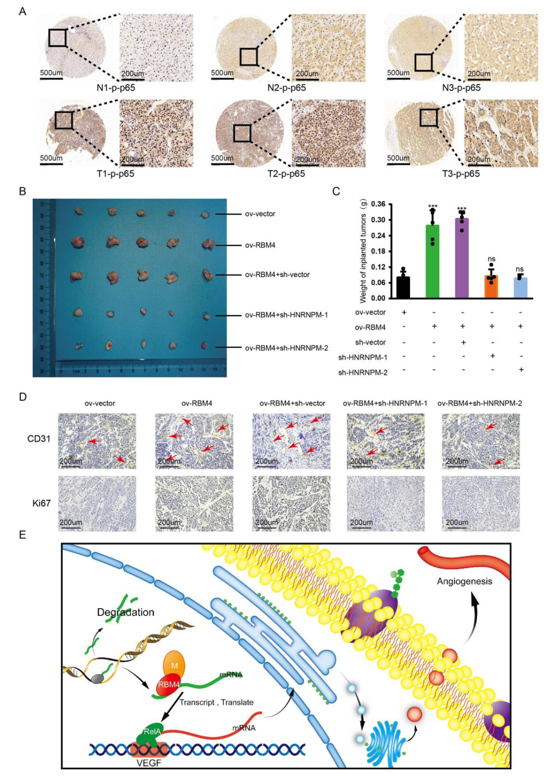 Pharmacol Res | 周国雄/叶军团队研究发现RBM4通过选择性激活VEGF-A的表达来促进肝癌中的血管生成 - 知乎