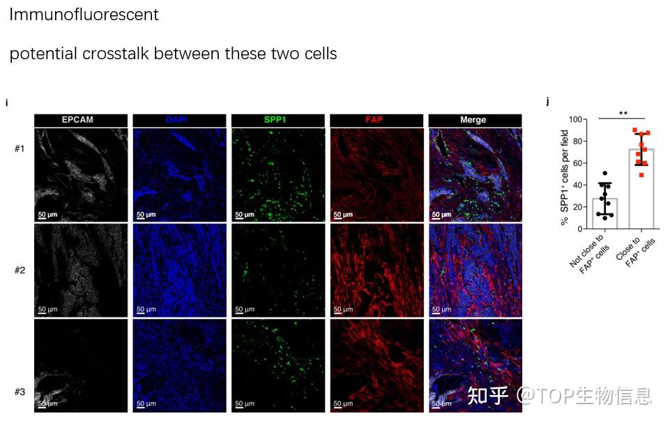 文献(8): 单细胞和空间分析揭示FAP+成纤维细胞和SPP1+巨噬细胞在结直肠癌中的相互作用 - 知乎