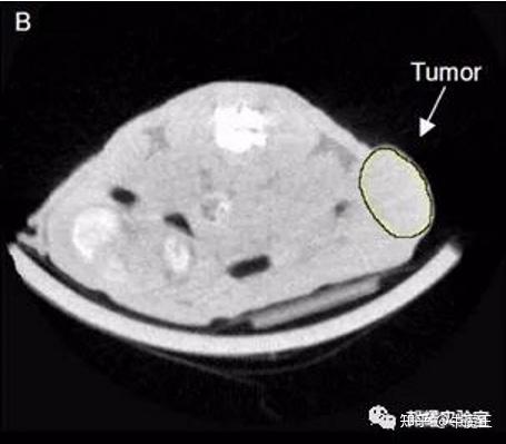 肿瘤体积测量 - 知乎