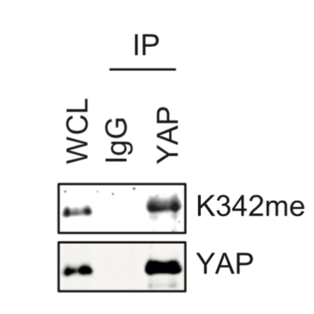 科研加料|蛋白翻译后修饰研究思路·发现篇 - 知乎