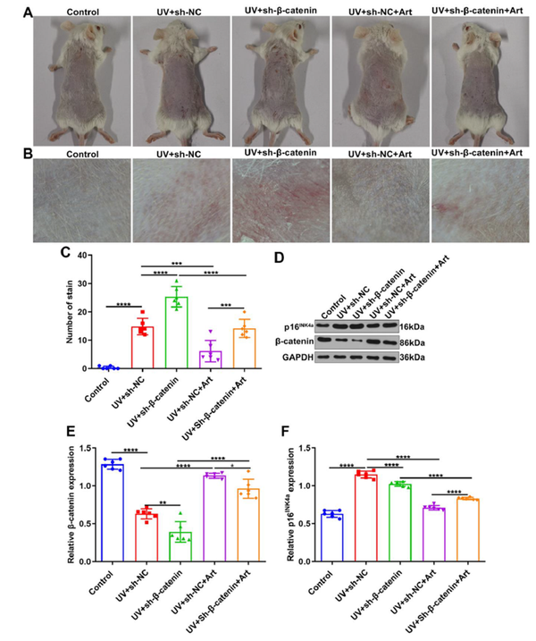 青蒿琥酯：一种青蒿素衍生物用以改善皮肤光老化 - 知乎