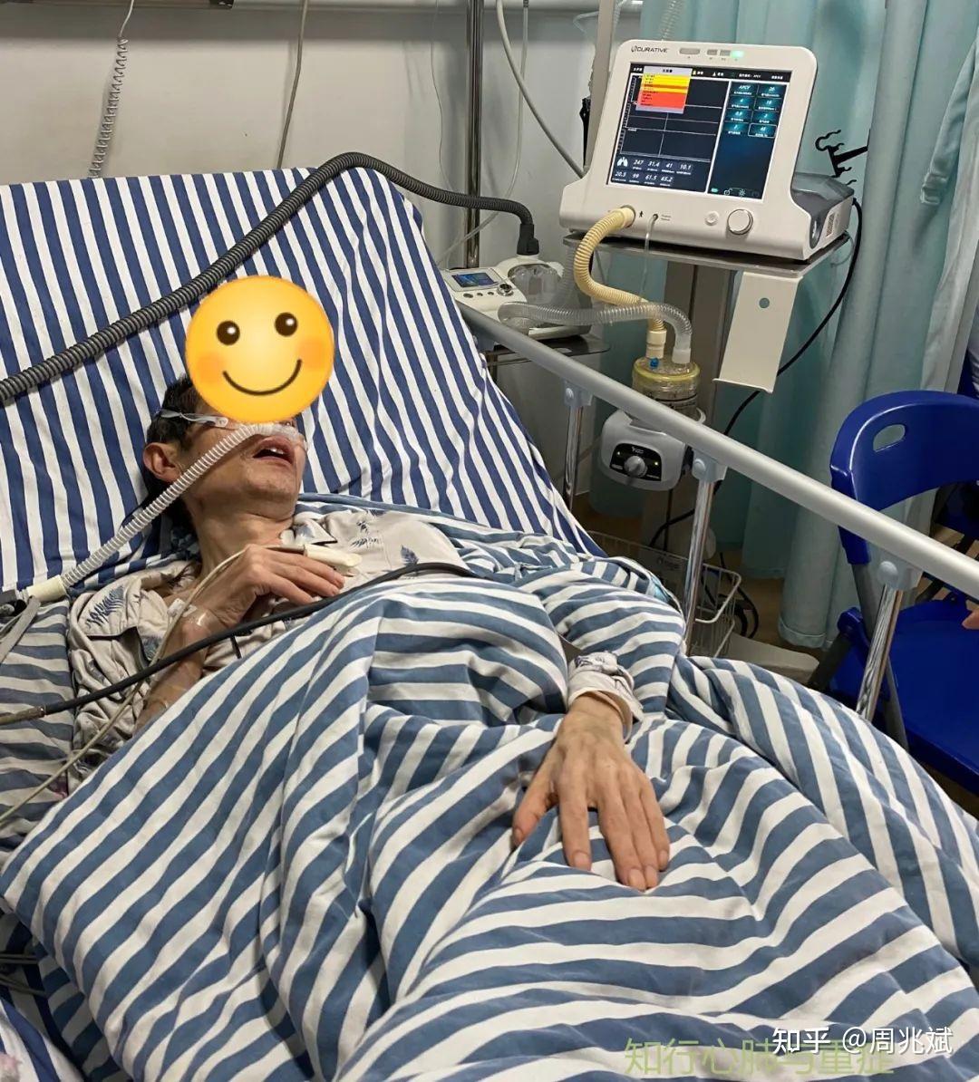 肺动脉高压的诊断与PAH危险分层 - 知乎