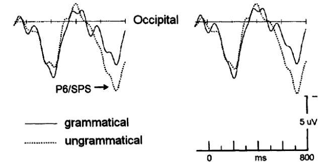 事件相关电位（4）：语言相关的ERP成分 - 知乎