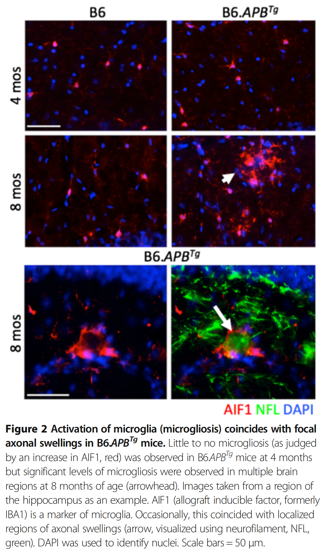 APP/PS1小鼠|AD模型 - 知乎