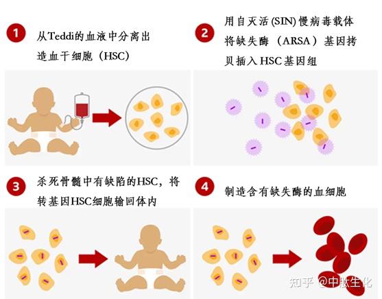 第一个接受商业化Libmeldy基因疗法的孩子，已无遗传病症状 - 知乎