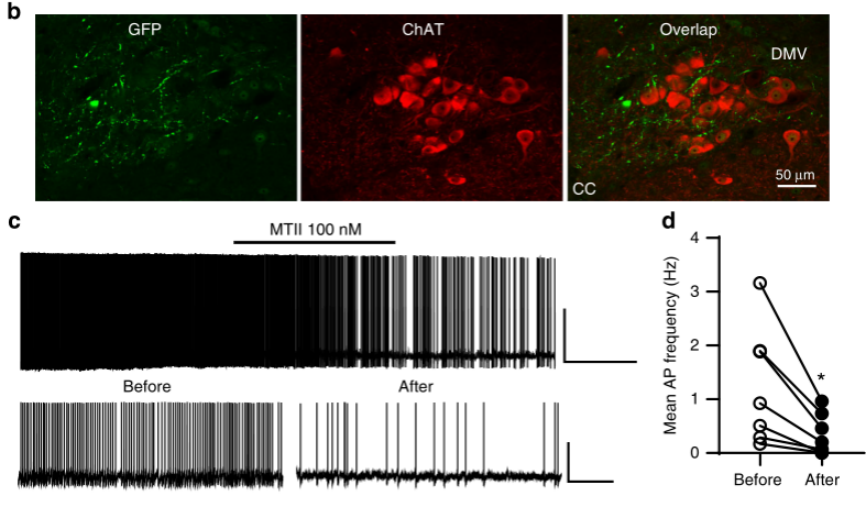 【文献解读】血糖高低谁主导？下丘脑弓状核POMC神经元调节血糖稳态的神经生物学机制 - 知乎