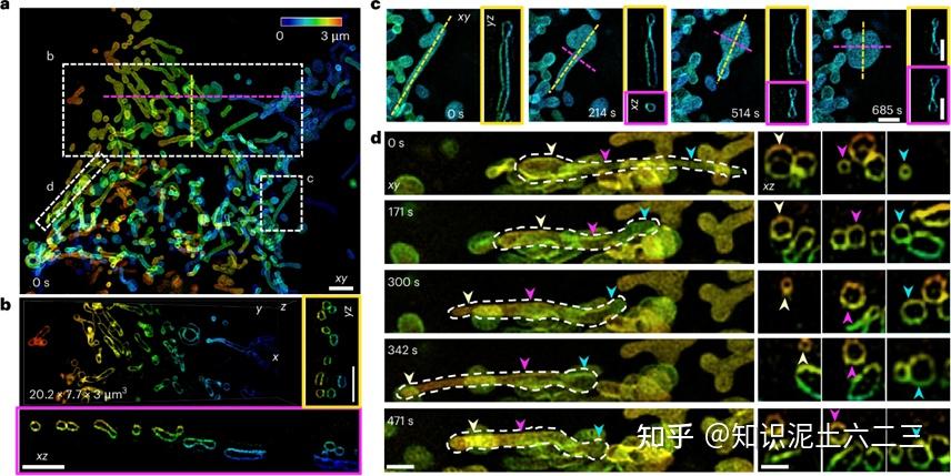 细胞成像的超级“放大镜”——4Pi-SIM - 知乎