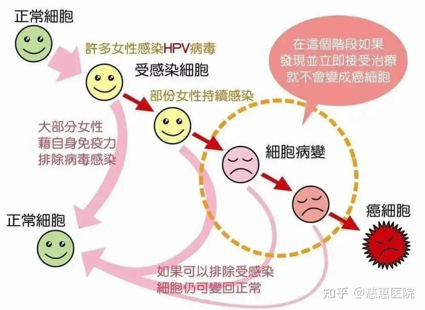 Hpv阳性会得宫颈癌吗?医生:别慌,这3点要做好! 知乎