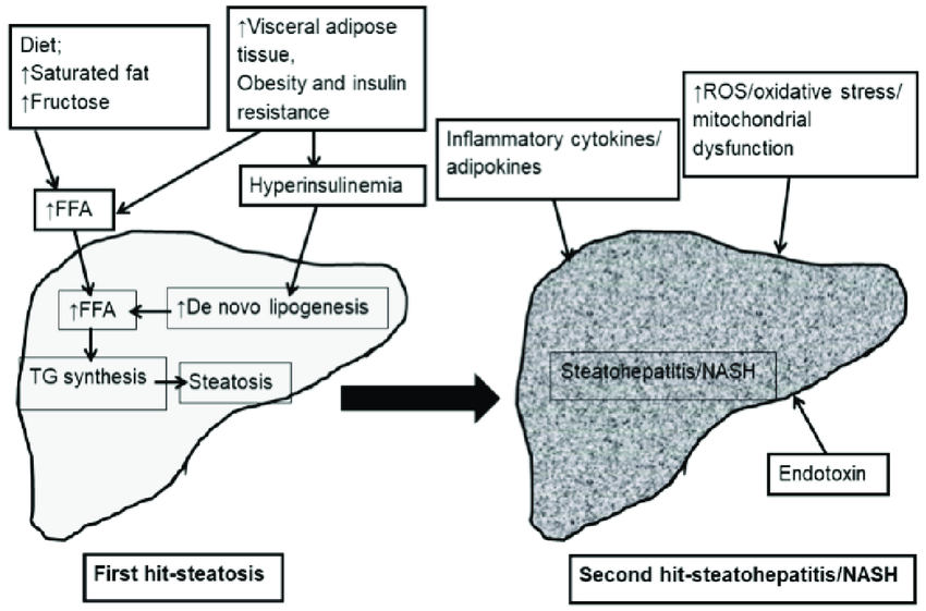 推荐 | NASH药物的冰火二十年 - 知乎