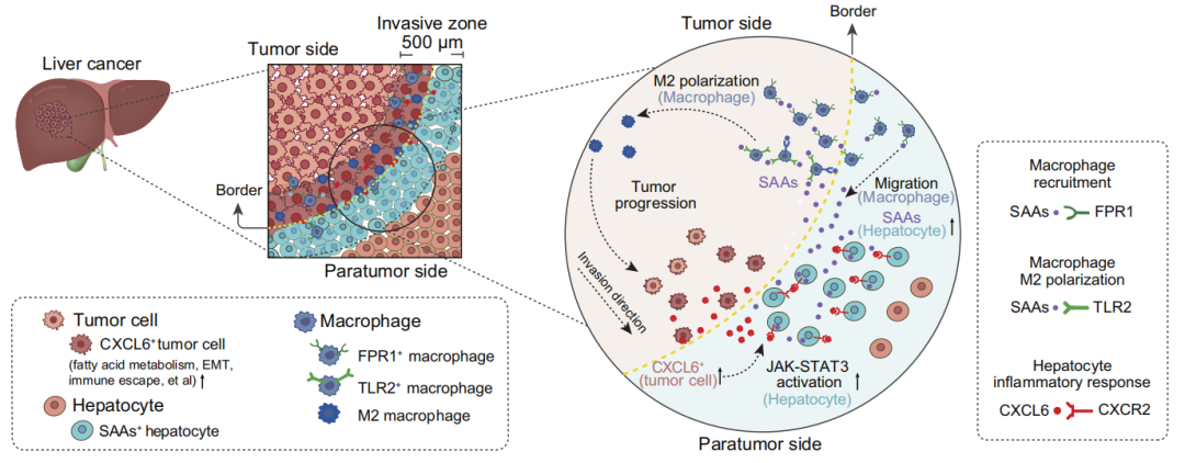 Cell Res | Stereo-seq揭示人类肝癌浸润区促进肝细胞-肿瘤细胞串扰、局部免疫抑制和肿瘤进展 - 知乎