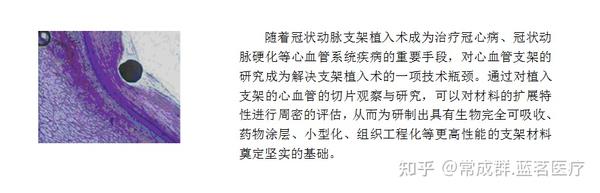 硬组织切片机是做什么用?硬组织材料切片用于骨组织切片、口腔病理切片、不脱钙骨骼和牙齿。 知乎