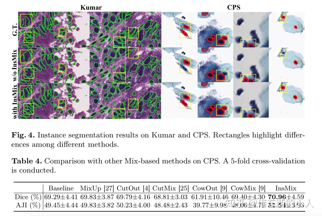 细胞核分割mixup+GAN:《InsMix: Towards Realistic Generative Data Augmentation for Nuclei Instance ...