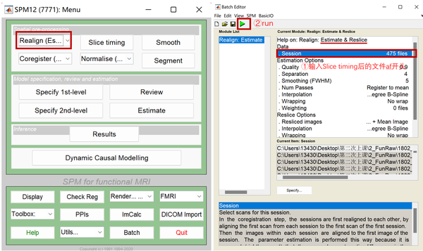 fMRI数据预处理 - 知乎